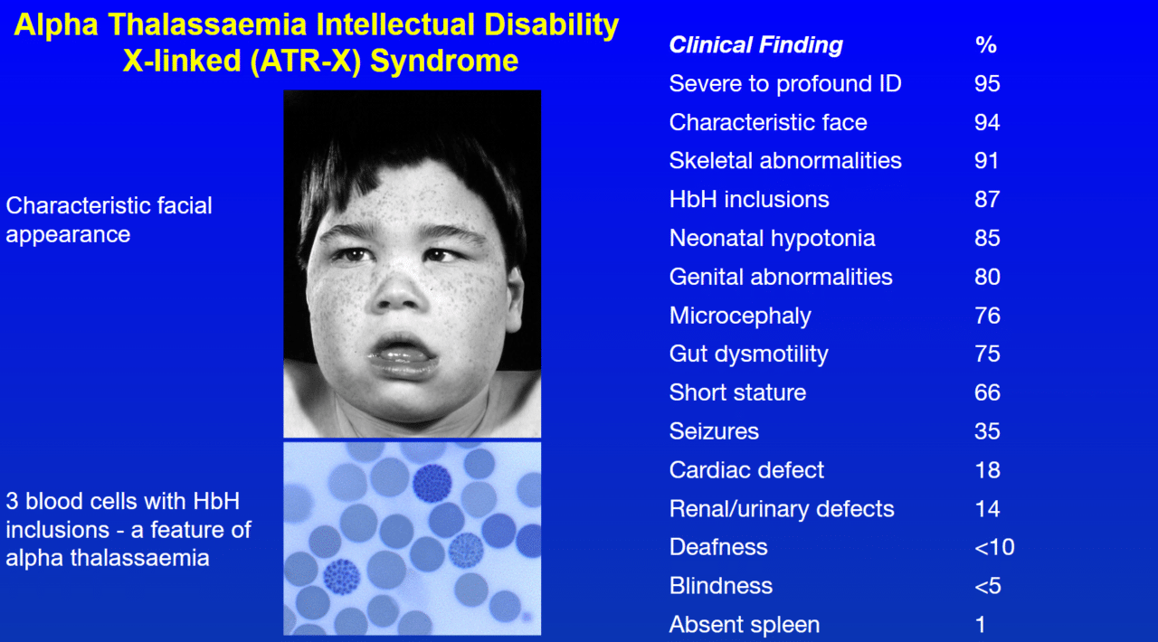 What is ATRX? - ATRX Research Alliance