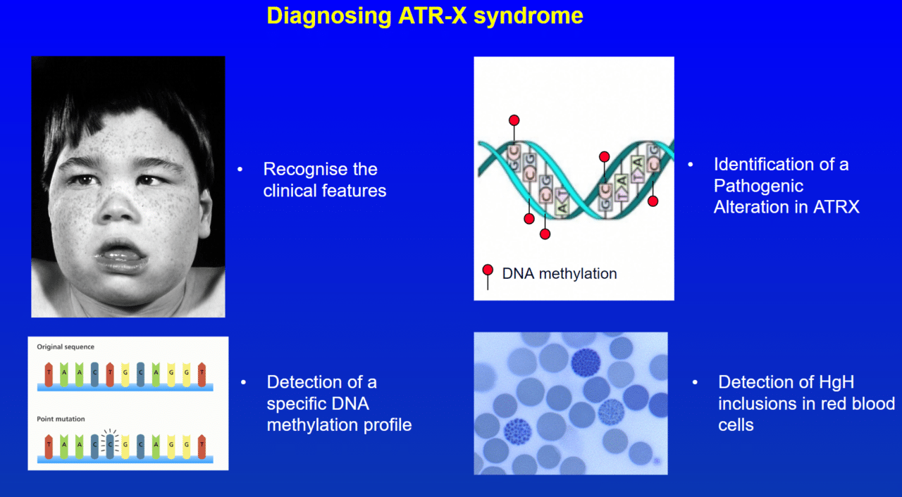 What is ATRX? - ATRX Research Alliance