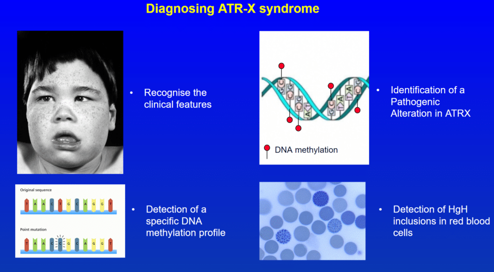 What is ATRX? - ATRX Research Alliance